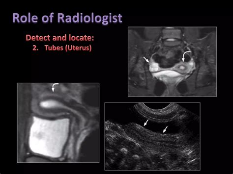 Practical Radiological Approach To A Case Of Intersex Ppt