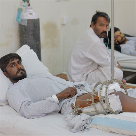 Open Reduction Internal Fixation Orif Indus Hospital And Health Network Open Reduction Internal Fixation Orif Indus Hospital And Health Network