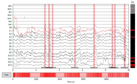 Eegsignal Processing Basics Part 1 Jin Jeon