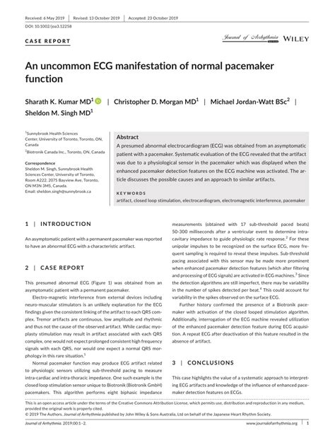 Pdf An Uncommon Ecg Manifestation Of Normal Pacemaker Function
