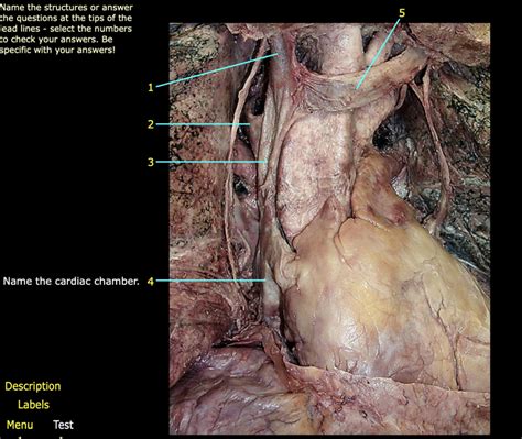 Superior Vena Cava Diagram Quizlet
