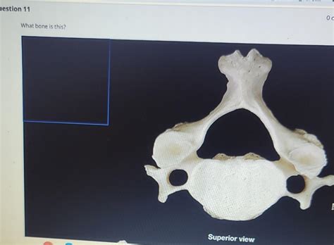 Solved Lestion 11 What Bone Is This