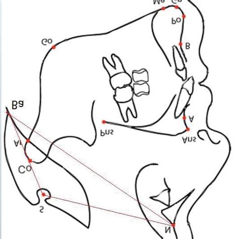 Cranial Base Measurements Download Scientific Diagram