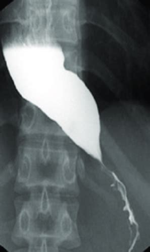 Radiolgoy Abdomen Flashcards Quizlet