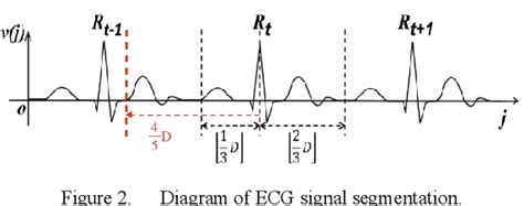Figure 1 From Inter Patient Ecg Classification Based On Residual