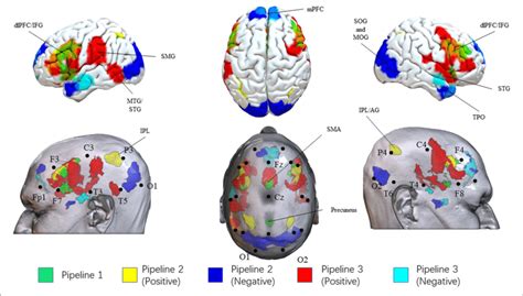 Results Of Three Pipelines Brain Surface Regions Identified From The Download Scientific