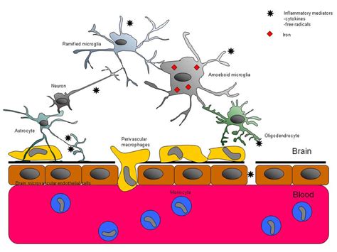 Amoeboid Microglia Accumulate Iron During Hypoxia And Produce Free