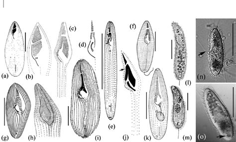 Molecular phylogeny of the scuticociliate, Philaster (Protozoa, Ciliophora), with a description ...