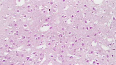 Motor Cortex Section Of Human Being Magnified Under Microscope 40 On