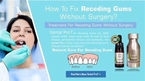 PPT Fix Receding Gums PowerPoint Presentation Free Download ID 8261582