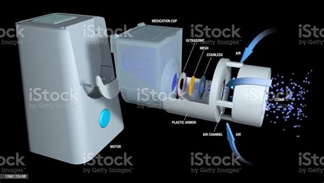 Descriptive Drawing Of How A Portable Nebulizer Works For The Treatment