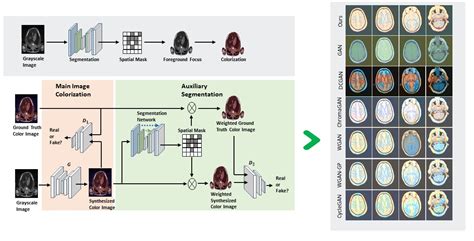 Robust Medical Image Colorization With Spatial Mask Guided Generative Adversarial Network