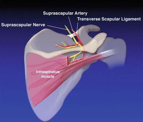 Suprascapular Nerve