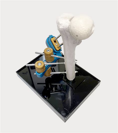 Dynamic Hip External Fixator