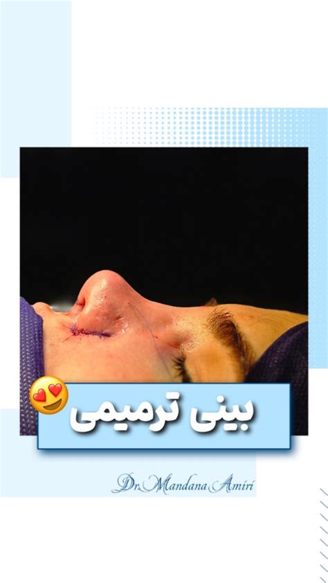 ‎دكتر ماندانا اميری جراح زیبایی‎ ‎دکتر ماندانا امیری جراح و متخصص