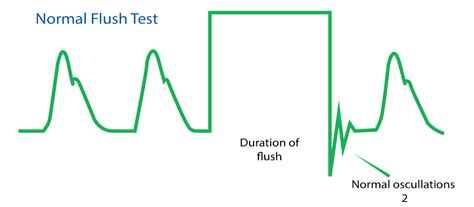 Arterial Line Insertion And Waveforms Criticalcarenow
