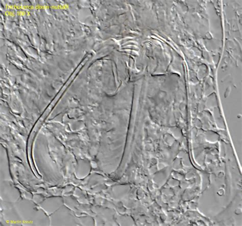 Trichocerca Dixon Nuttalli Real Micro Life