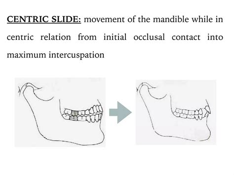 Centric Relation Seminar Pdf