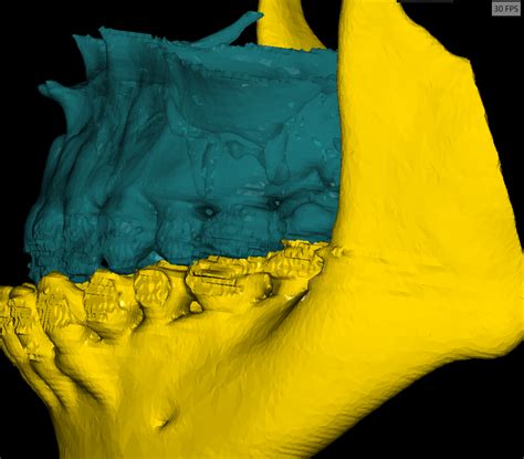 About Transparency Setting Issue Helix Toolkit Helix Toolkit GitHub