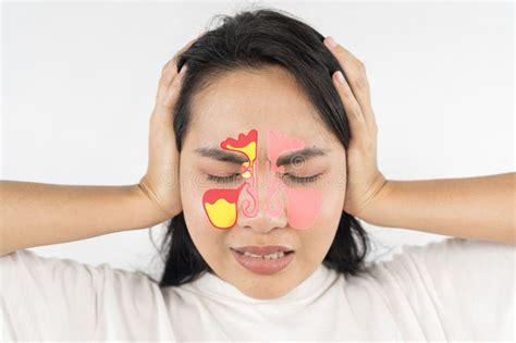 Sinusitis Frontitis Female Face With Inflammation Of Mucous Membrane