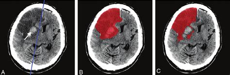 Lesson 4 Image Segmentation Walkwithfastai