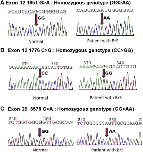 DNA Sequencing Results Of Three Missense Mutations Identified On The Download Scientific