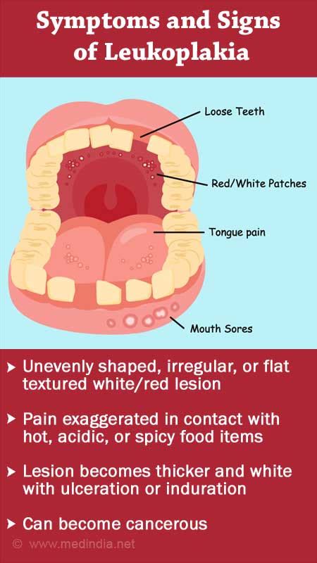 Leukoplakia Gums