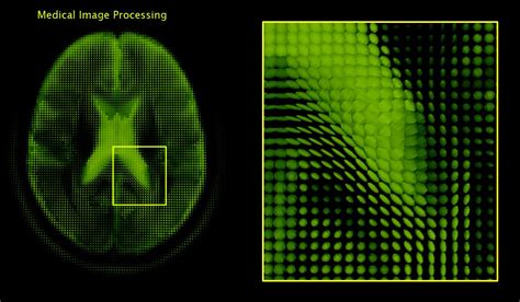 medical image analysis with deep learning — i by taposh dutta roy