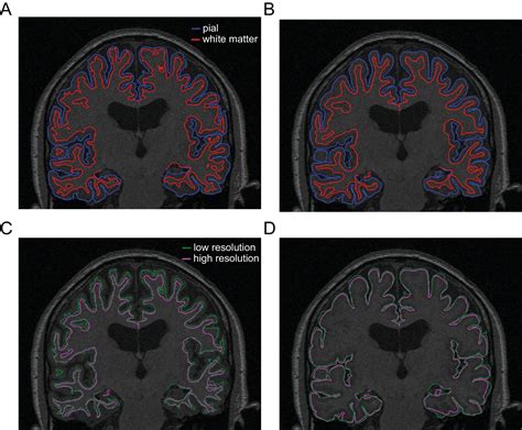 Figures And Data In Lamina Specific Cortical Dynamics In Human Visual And Sensorimotor Cortices