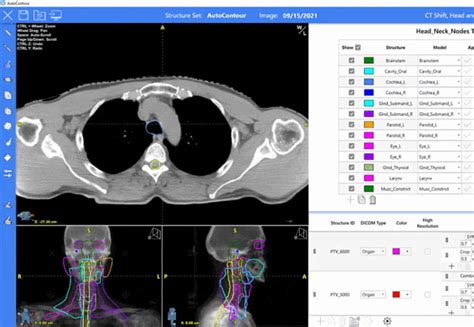 AutoContour AI Driven Deep Learning Contours Medisynt