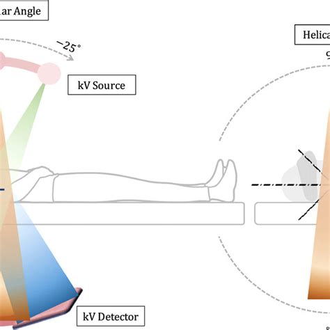 overview of the treatment planning workflow starting with a cbct