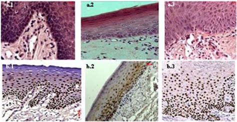 The representative microphotographs of NOM, OSFWt and OSFW at 400x ...
