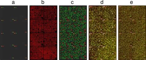 Quality Control Measures For An Antibody Microarray Of 1800 Features