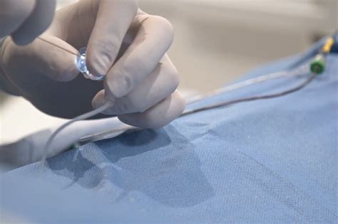 Waterloo Undergrad Project Became 9m Startup That Sends Cameras Into Human Brains The Logic