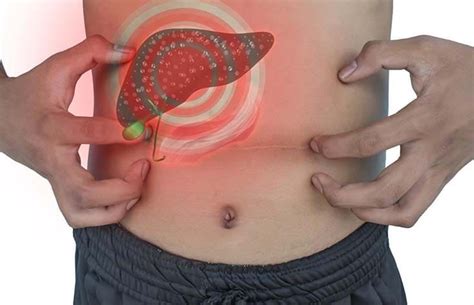 Treatment For Liver Disease