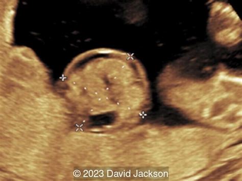 Case Of The Week 579