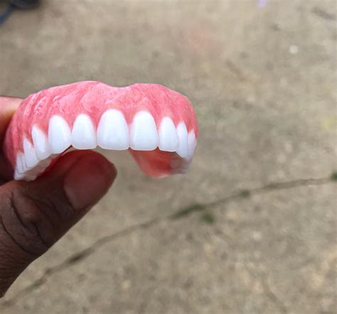 Full Upper Pw7 Shade Jos Dentures Lab