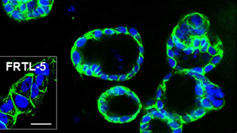 Fundraiser By Rebecca Rossi Thyroid Stem Cell Project At Mount Sinai