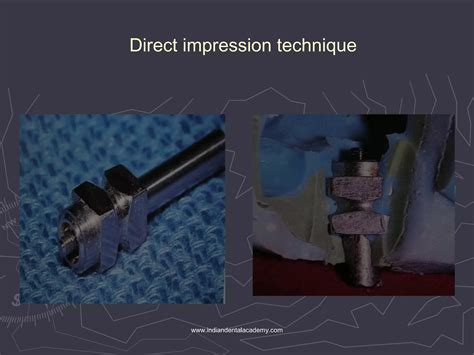 Classification And Impression Techniques Of Implantsprosthodontic