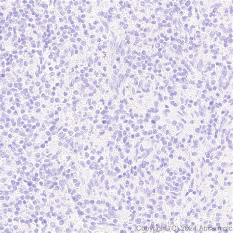 Anti Hsd17b13 Antibody Epr28344 54 Ab316153 Abcam