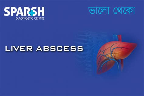 Liver Abscess Causes Symptoms Diagnosis Treatment And Prevention