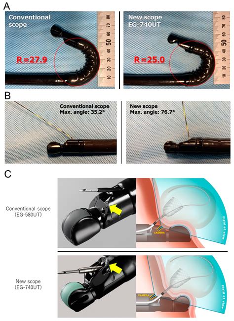 Dedicated Echoendoscope For Interventional Endoscopic Ultrasound