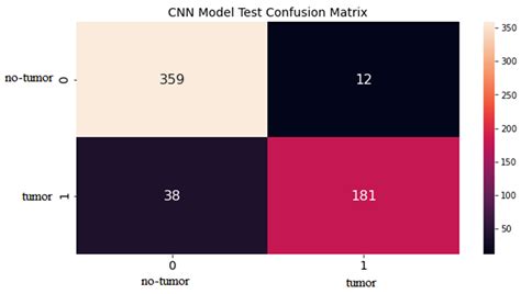 Brain Tumor Detection And Classification Using Fine Tuned Cnn With Resnet50 And U Net Model A