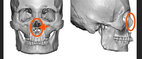 Homo Heidelbergensis Vs Neanderthal Sex And Relationships Kenya Talk