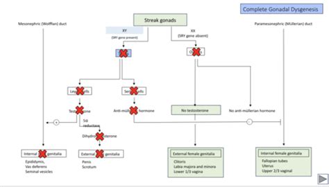 Differences Of Sex Development Conditions Flashcards Quizlet