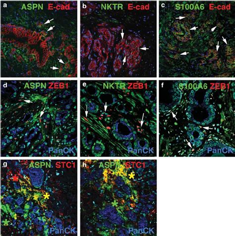 Colocalization Of Identified Candidates To Determine Co Expression With Download Scientific
