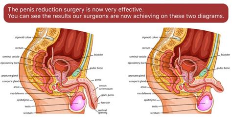 Alpha Vs Beta Freakden