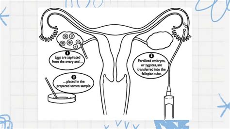 Assisted Reproductive Techniques Powerpoint Ppt