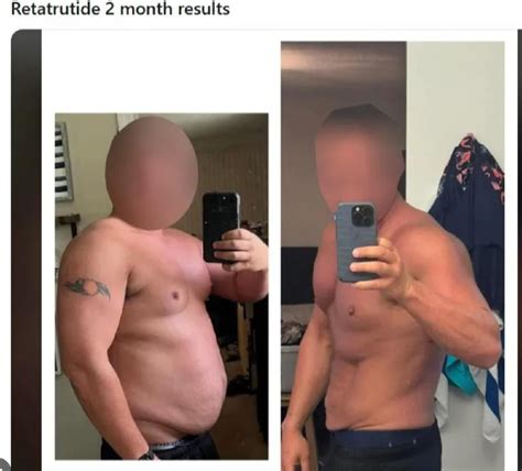 Retatrutide Reviews Real User Results Side Effects And Beforeafter