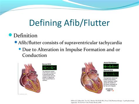 Atrial Fibrillation Flutter Presentation Ppt Heart And